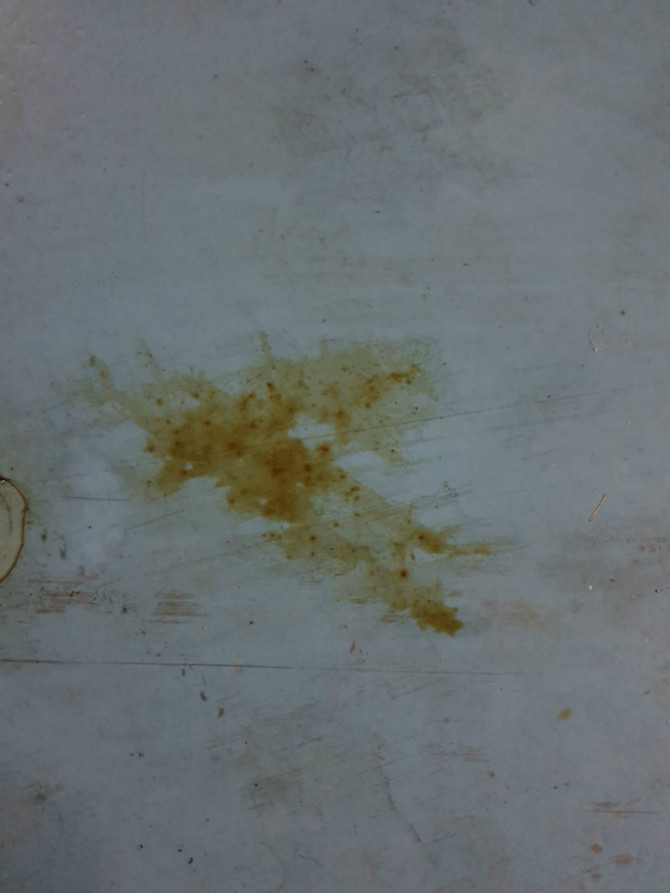 안녕하세요. 아반떼 누유 관련 고수님들께 여쭤봅니다. | 보배드림 국산차게시판